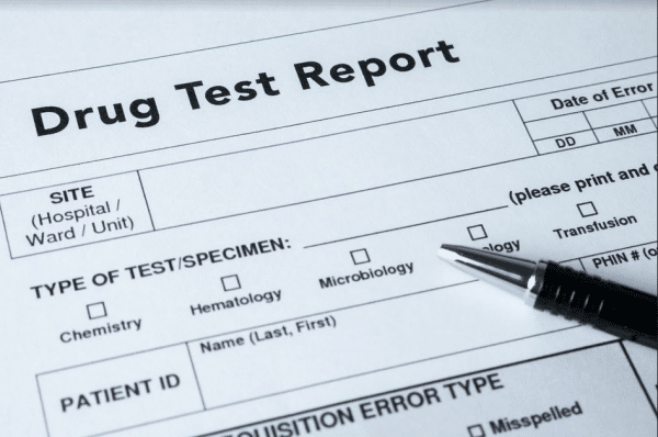 When and How to use Drug Test Kits for Your Office Employees